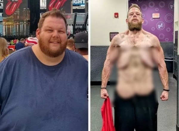 150㎏ 감량한 美 남성…사진 보여주기 꺼린 이유는 - 아시아경제