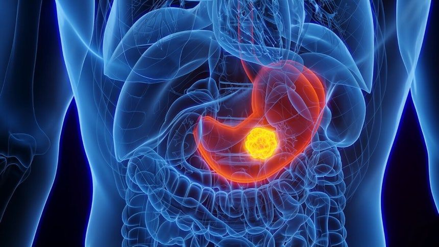 Sharing Spoons from One Pot: Korean Communal Stew Culture Increases ...